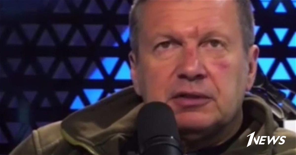 Соловьев вышел в эфир своей программы с синяками и ссадинами на лице ...