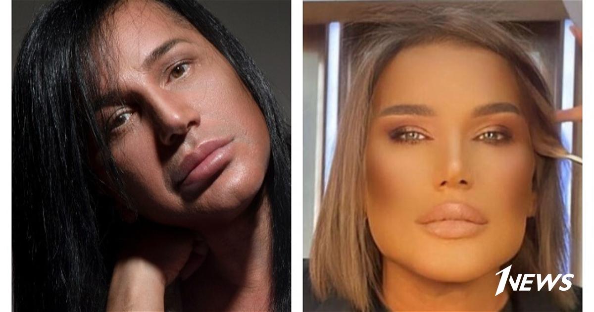 Как Самир Багиров выглядит после пластической операции? – ФОТО | 1news.az | Новости